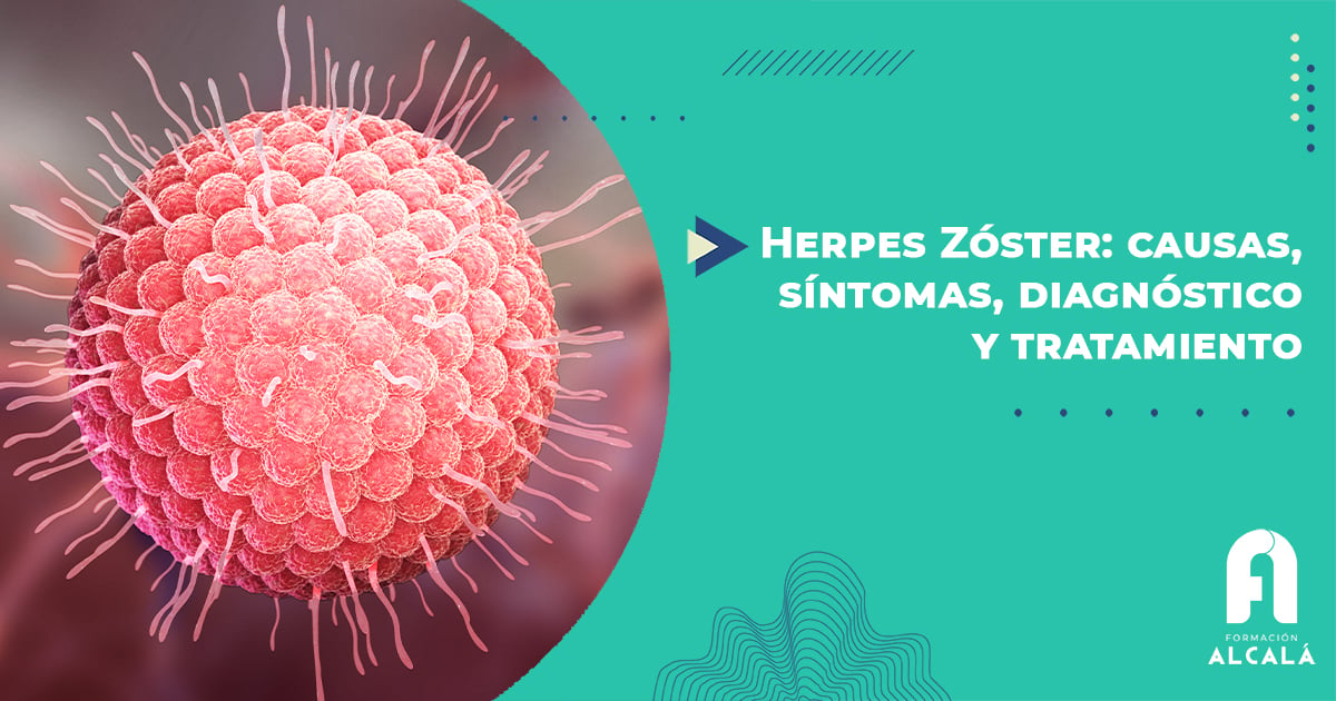 Herpes Zóster: causas, síntomas, diagnóstico y tratamiento