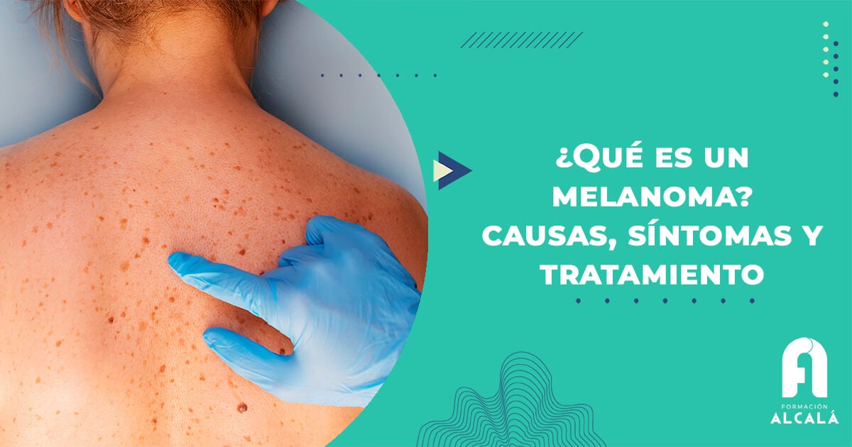 ¿Qué es un melanoma? Causas y síntomas | Formación Alcalá