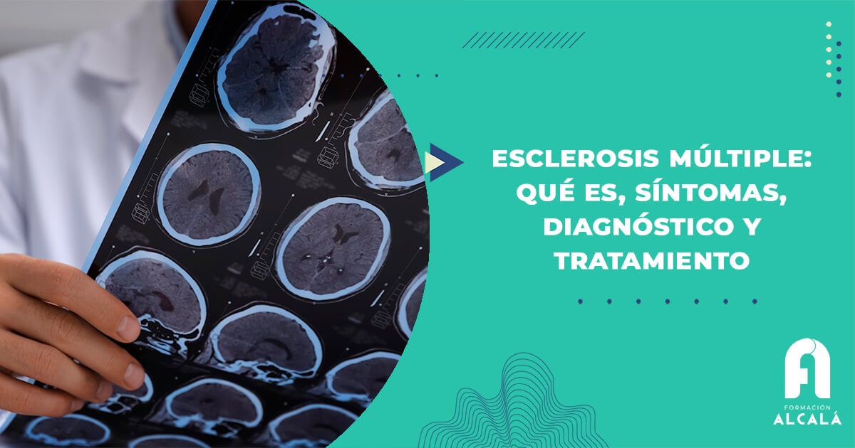 Esclerosis Múltiple| Formación Alcalá