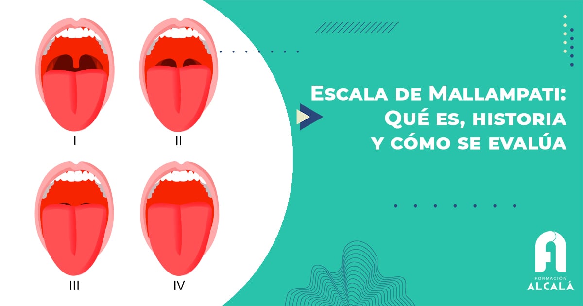 Escala de Mallampati: Qué es, historia y cómo se evalúa